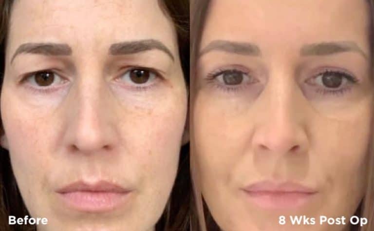 Skin Surgery Clinic | Dermatology & Skin in Leeds and Newcastle