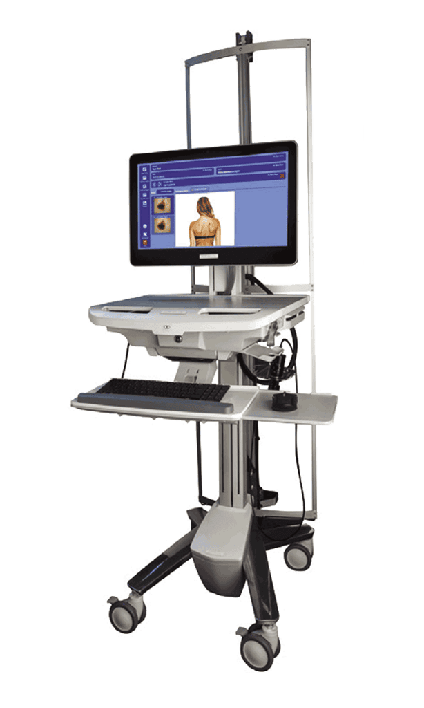 Mole Checks | Skin Surgery Clinic